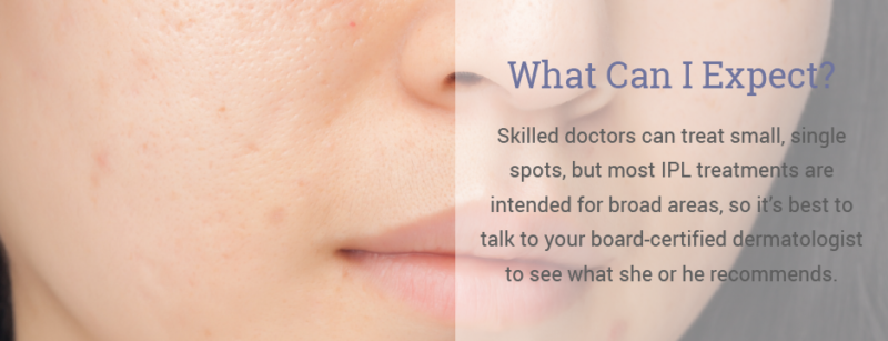 What Is IPL Therapy? - Art of Dermatology | New York