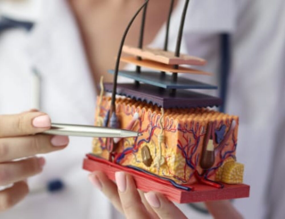 How to Get Rid of Post-Inflammatory Hyperpigmentation (PIH) - Art of ...